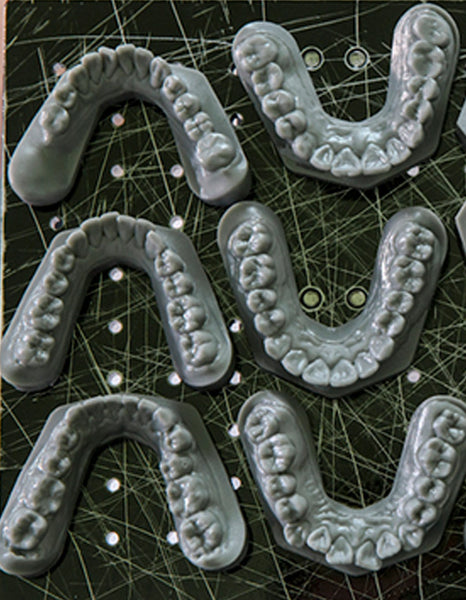 3D Print Aligner Model Service – Fabdent Dental Products and Services